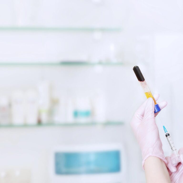 Exosomes vs Platelet-Rich Plasma (PRP) – JuveXO