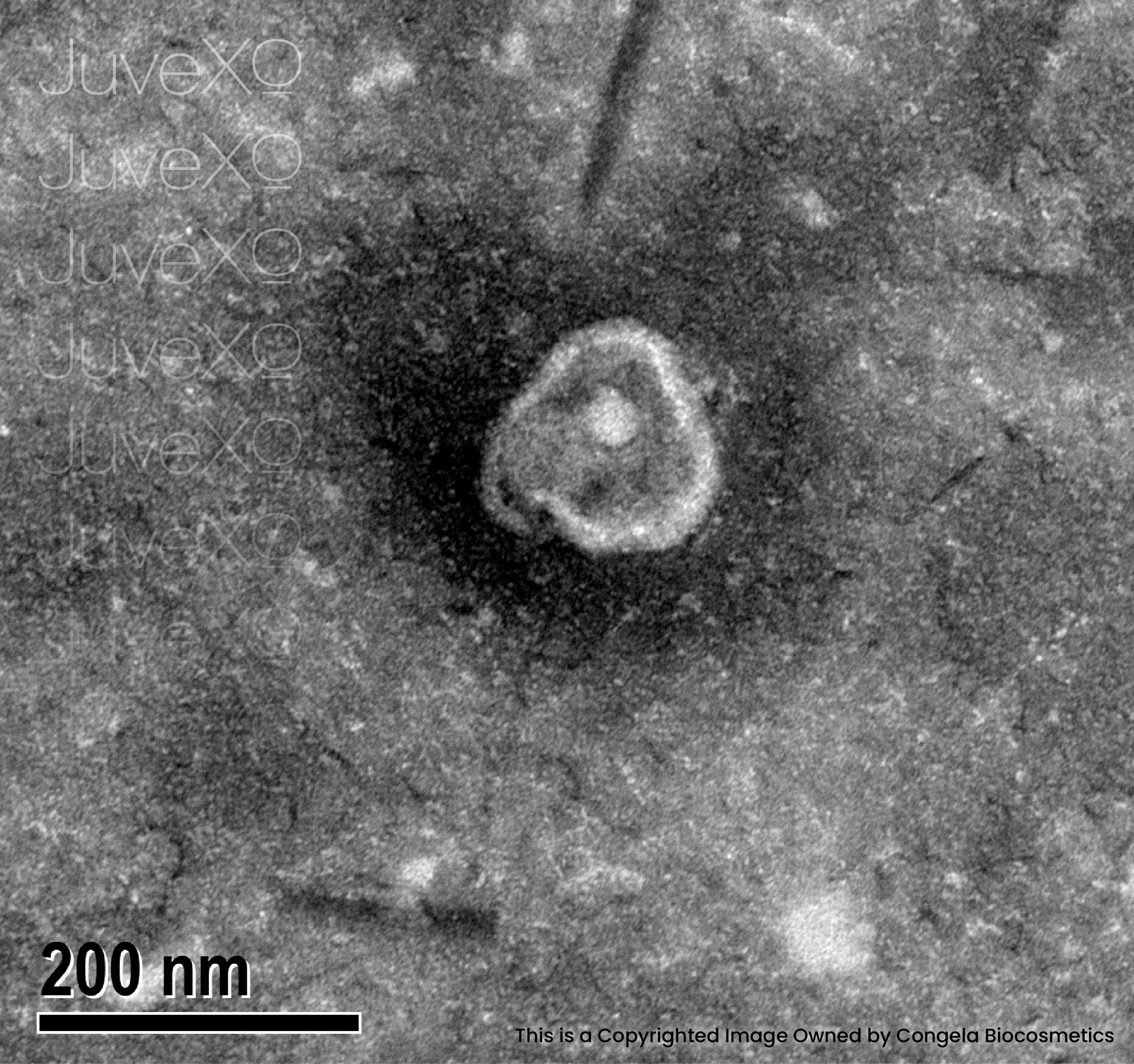Breaking Ground: JuveXO®'s First Image of an Exosome – A New Era in Sc
